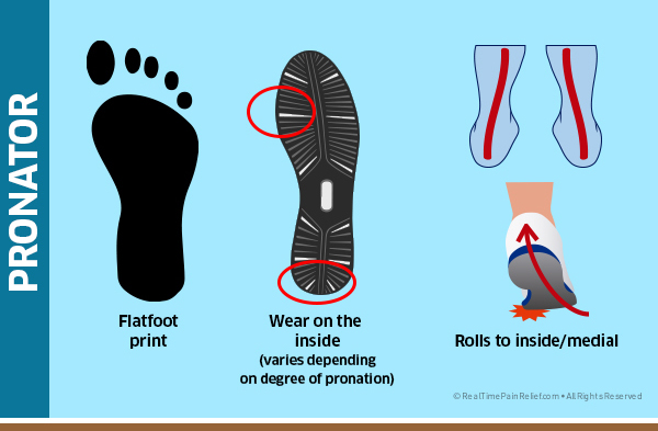 How to Figure Out Your Foot Type | Real Time Pain Relief